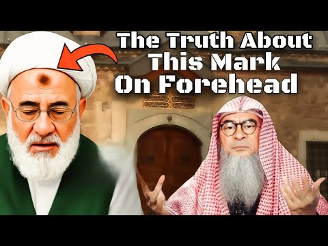 The Truth About The Prayer Mark’s On The Forehead!! #assim #dua #allah ...