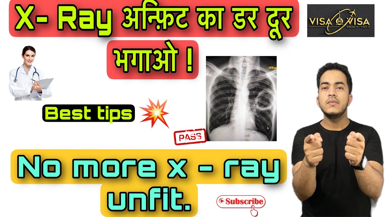 Gamca medical, No more X- Ray unfit problems. अब नहि होगा आपका x - ray ...