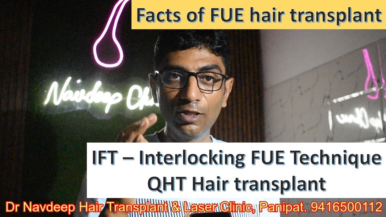 IFT Interlocking FUE Technique | Interlocking Graft Transplant ...