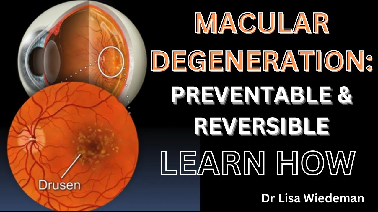 Easy to Understand Explanation PROTECT YOURSELF FROM LOSING VISION from ...