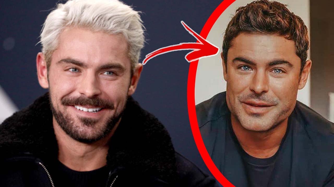 Male Celebrity Before And After Plastic Surgery