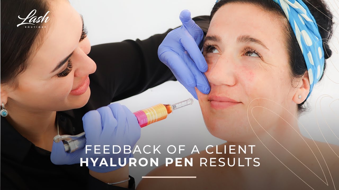 FeedBack of a Client - Hyaluron Pen Results | Lash Boutique Cape - YouTube