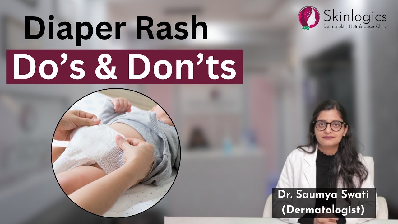 Diaper Rash Treatment | Best Skin Specialist in noida | Skinlogics ...