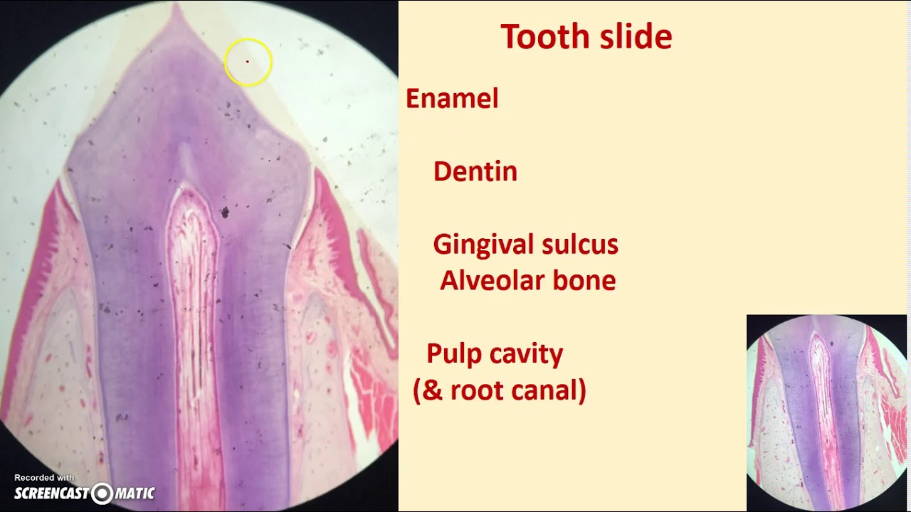 Lung & tooth slides (R. Abney & D. Madden) - YouTube