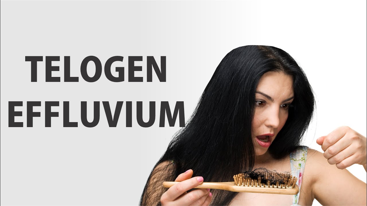 Understanding Telogen Effluvium - Causes, Symptoms & Treatment | Hair ...