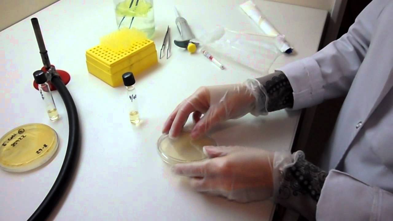 Test de Hodge - YouTube