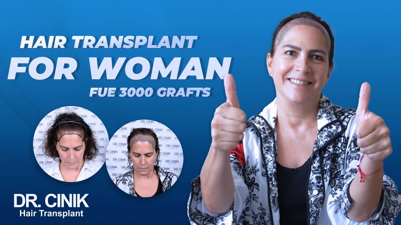 Dr.Cinik Hair Transplant For Woman | FUE | 3000 Grafts - YouTube