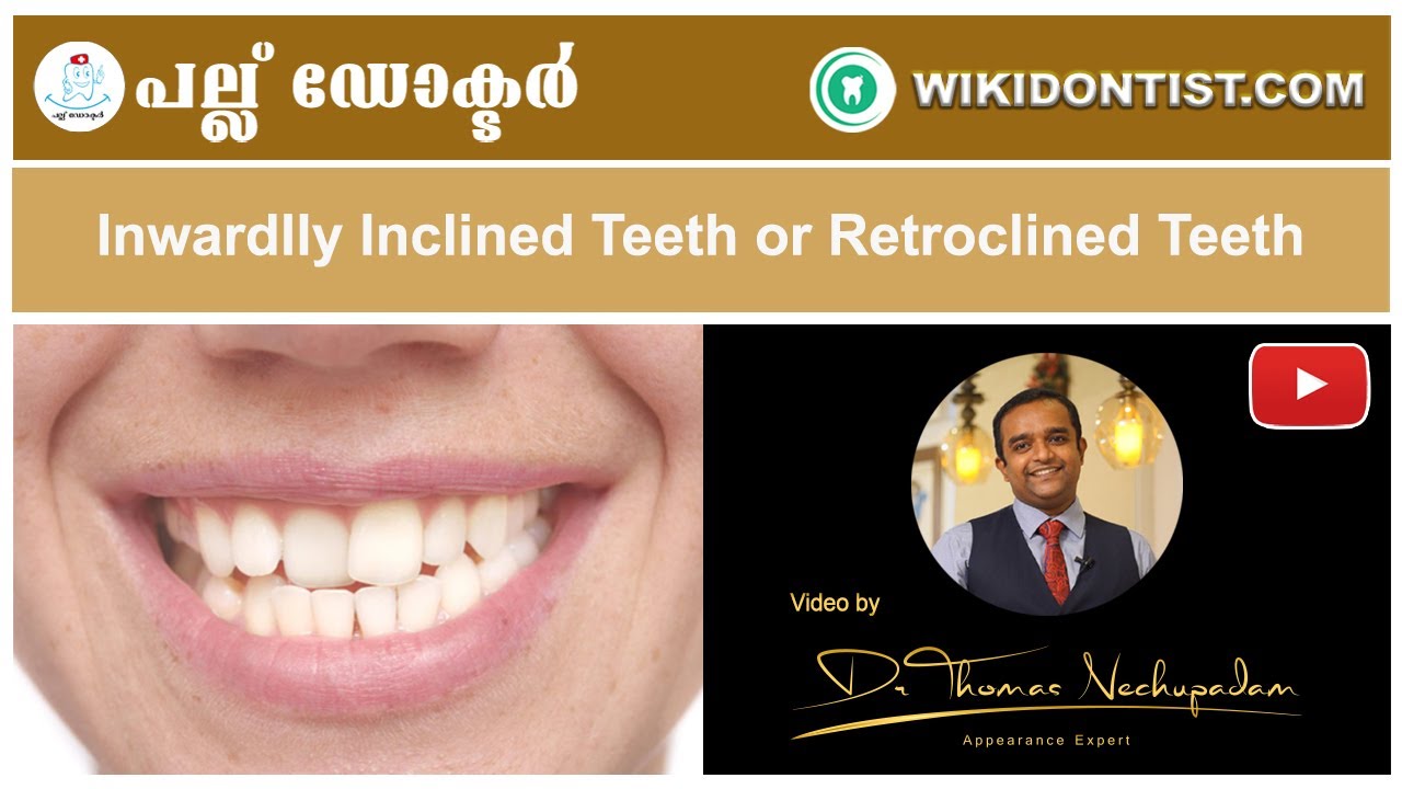 Inwardlly Inclined Teeth or Retroclined Teeth - YouTube