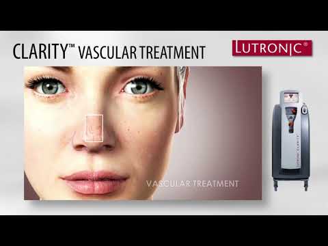 The CLARITY System - YouTube