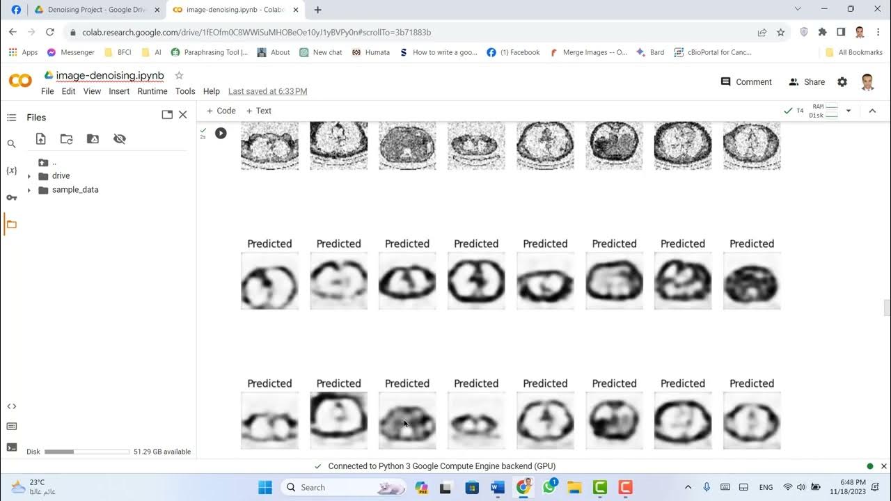 Project Denoising Brain Tumor Using Autoencoder عربى Youtube
