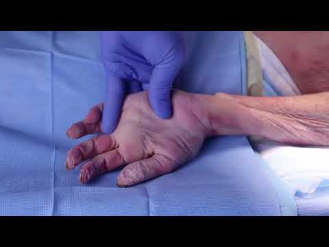 Proximal Humerus: Ch. 2 - Site Identification, Alt. Arm Positioning ...