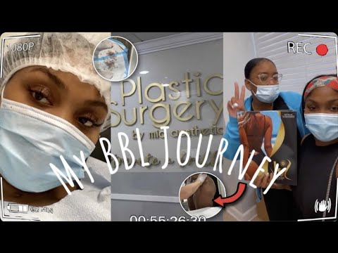 My First BBL Journey MIAMI 2021 | MIA AESTHETICS | DR.WRIGHT + 6 Month ...