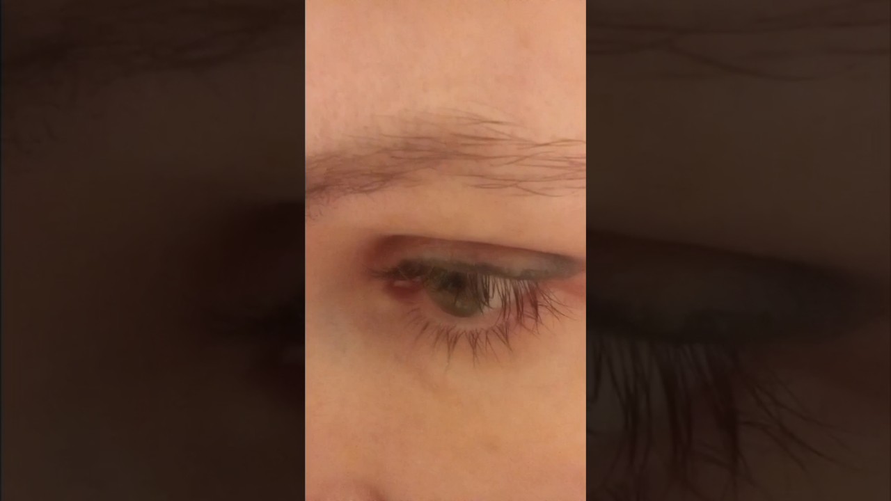 Брови Под Микроскопом / Eyebrows Under the Microscope #shorts # ...