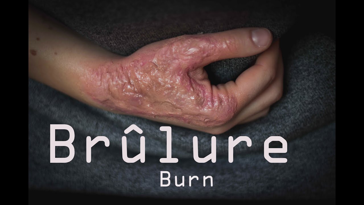 Brûlure vive réaliste ! SFX makeup - Burn tutorial (3rd Silicone) - YouTube