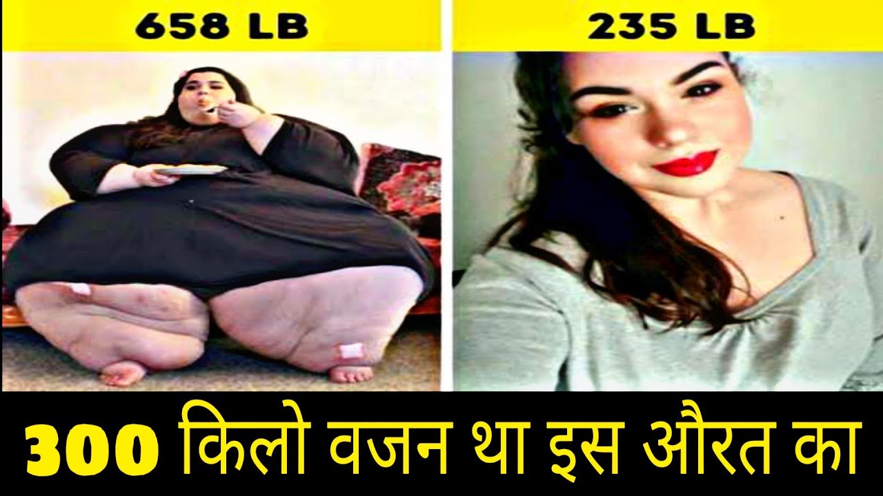 This girl weighed 300 kg, then see what happened to her -इस लड़की का ...