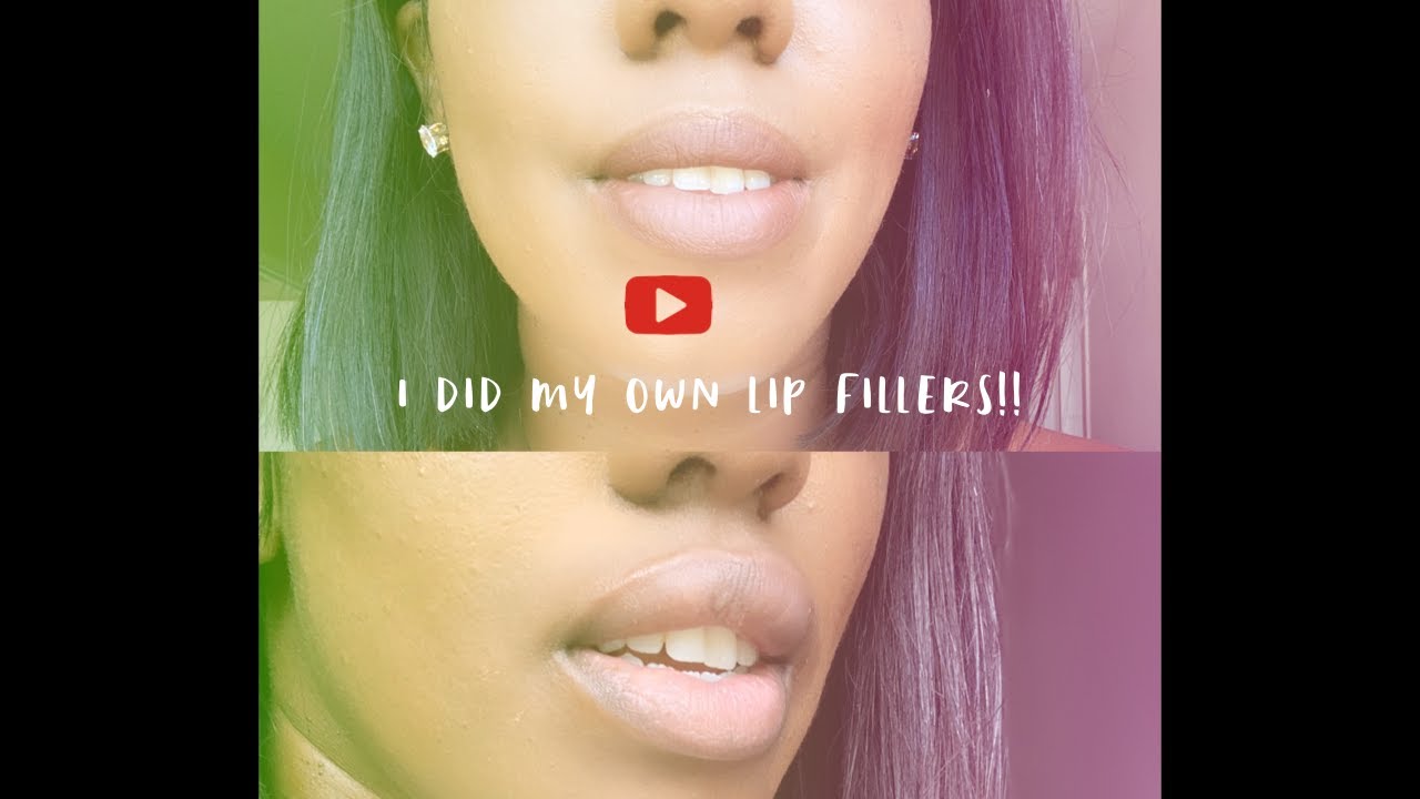 Needless Fillers!! - YouTube