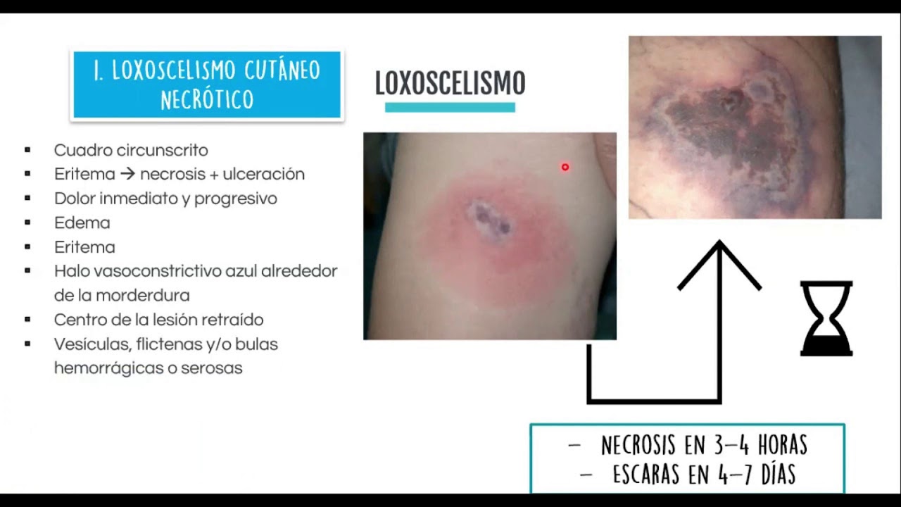 Urgencias Dermatológicas - YouTube