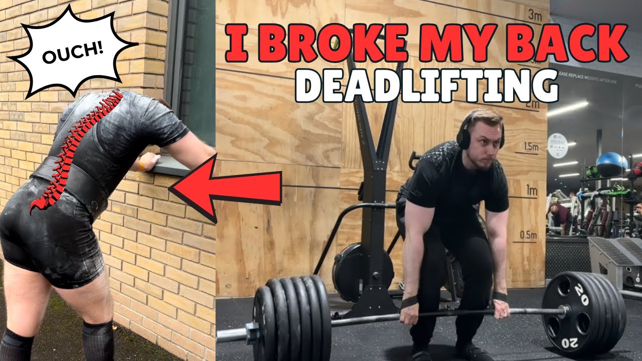 I HURT MY BACK DEADLIFTING | How to recover from a back tweak in the ...