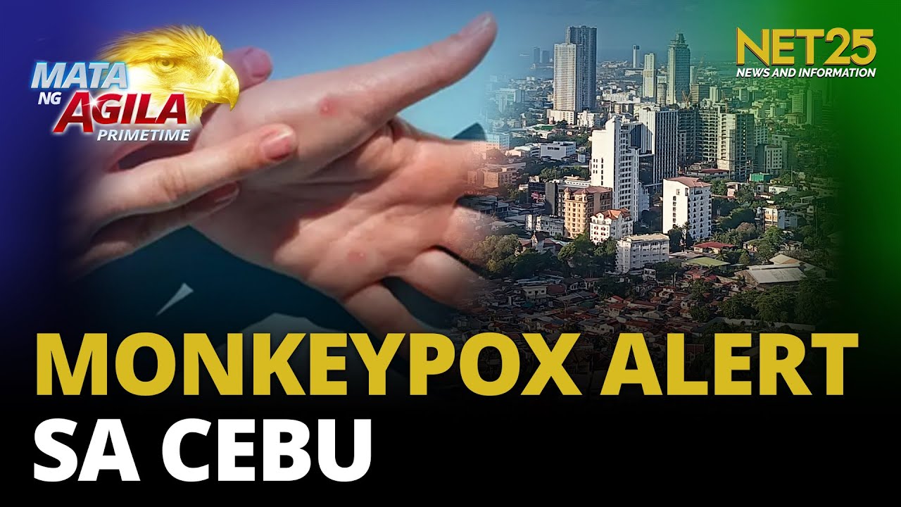 Monkeypox task force inilunsad sa Cebu; face mask, di epektibo ayon sa ...