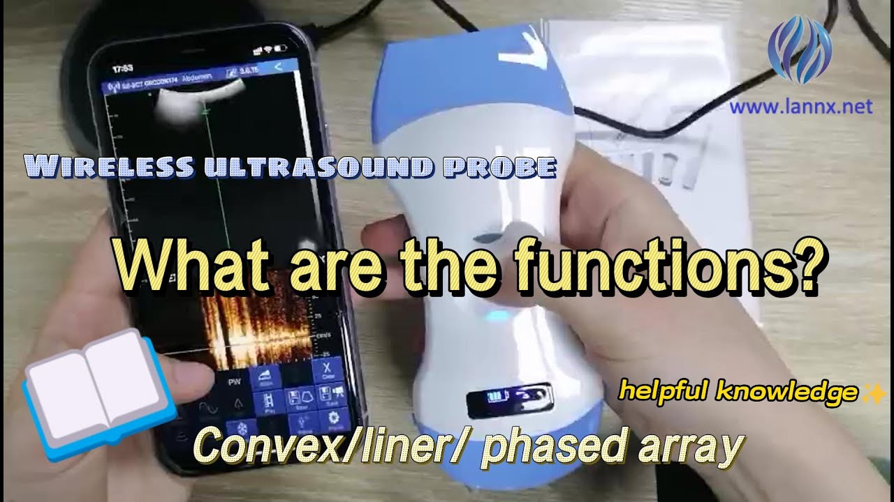 What are the functions for wireless ultrasound probe? - YouTube