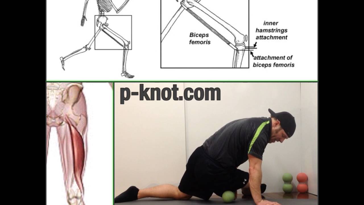 P-Knot Pigeon the Biceps Femoris to help that lateral knee pain. - YouTube