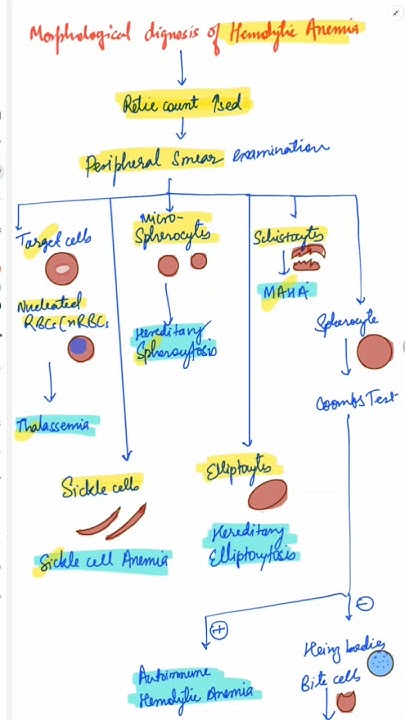 Hemolytic Anemia morphologic diagnosis #anemia #hemolyticanemia # ...