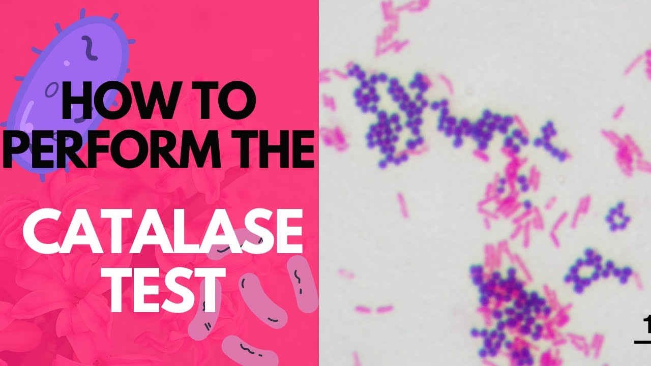 How to Perform the Catalase Test-Microbiology - YouTube