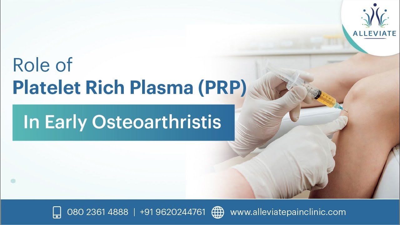 Role of PRP in Early Osteoarthritis | Stages of OA Explained | Benefits ...