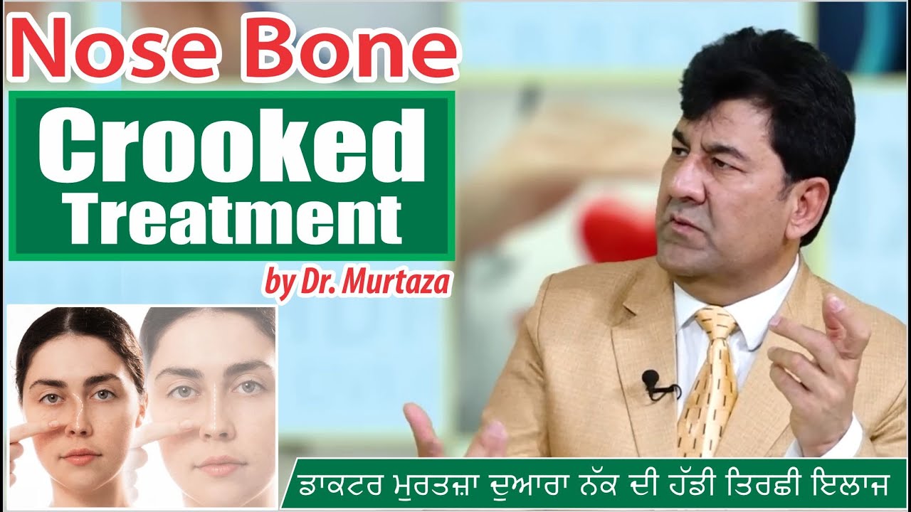 Nose Bone Crooked Treatment by Dr Murtaza – Fix Your Nose Fast! - YouTube