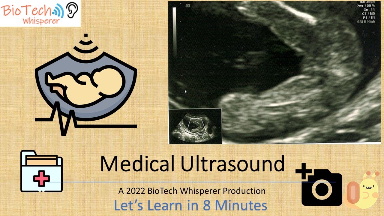 Learn about Medical Ultrasound Technology in 8 Minutes - YouTube