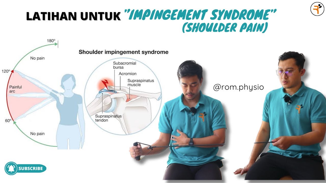 Cara Mengatasi “SHOULDER IMPINGEMENT” (Nyeri Bahu) #romfis - YouTube