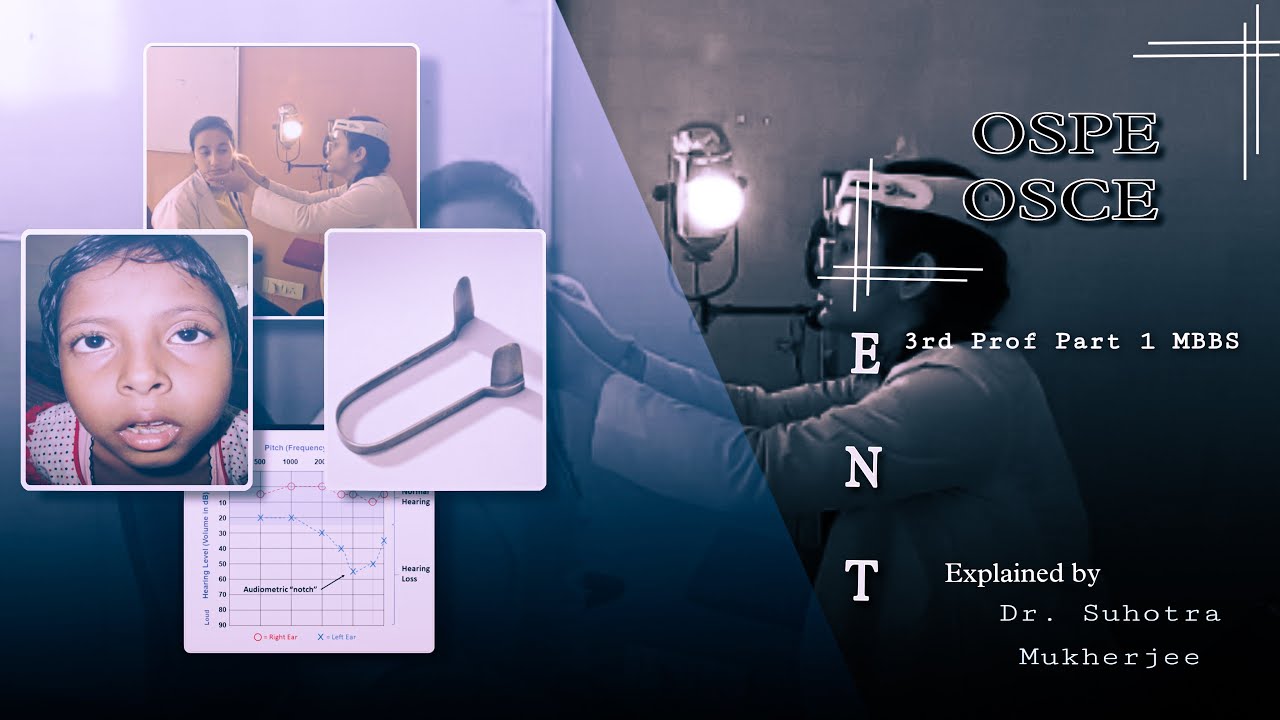 OSPE | OSCE | Briefly discussed | (with notes provided) - YouTube