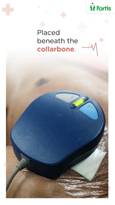 Never miss a beat with the pacemaker - YouTube