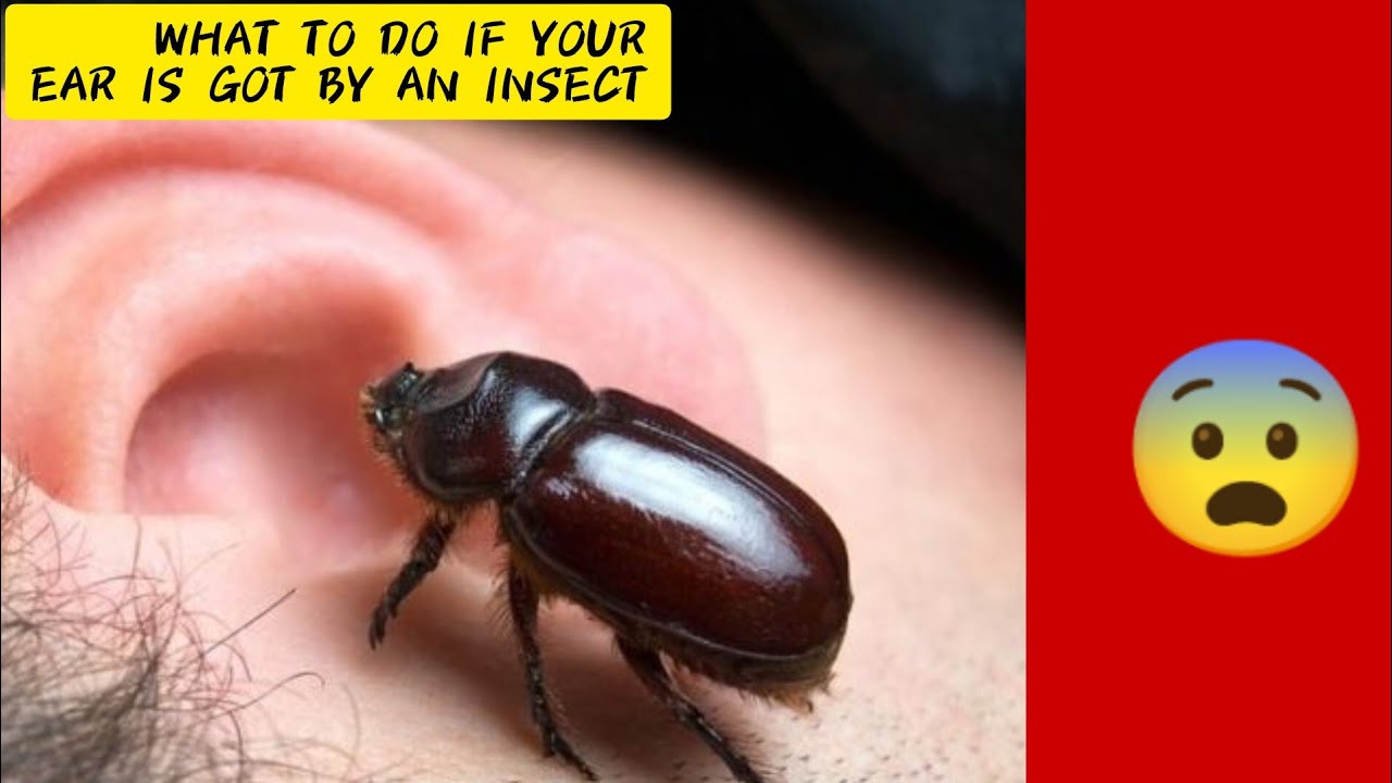 AN INSECT IS IN THE EAR WHAT TO DO - YouTube