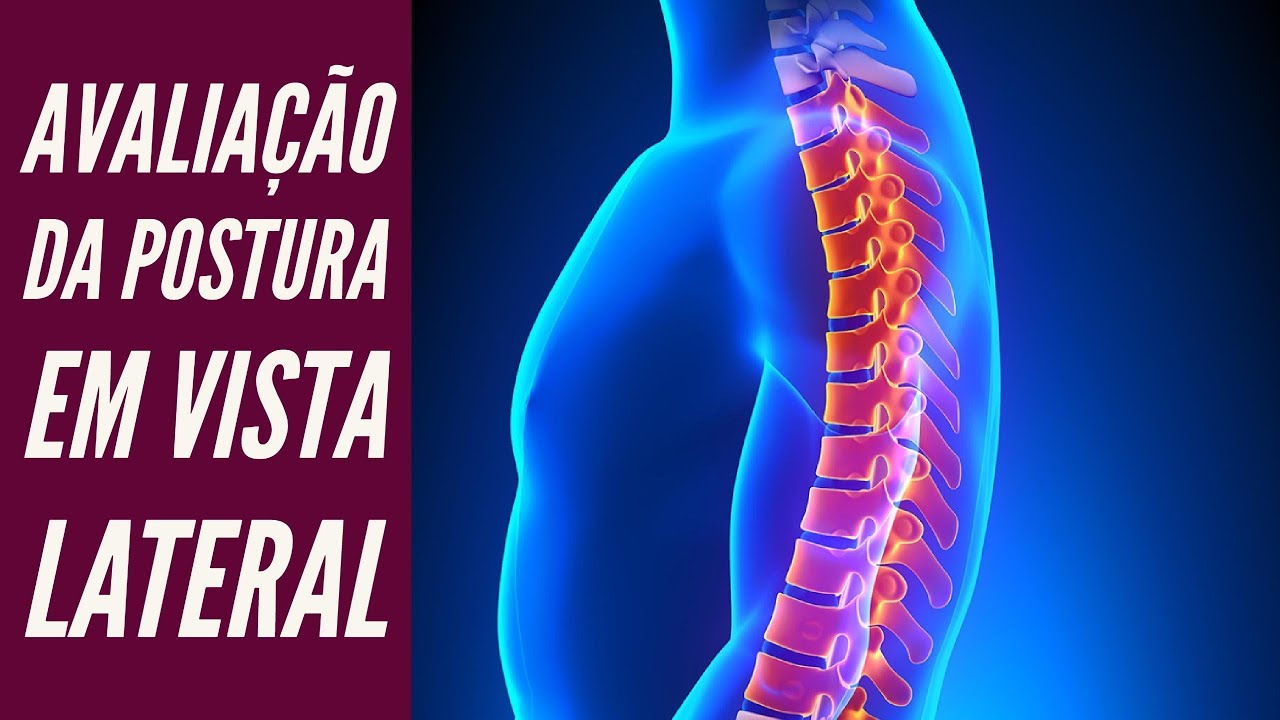 Avaliação da Postura em Vista Lateral - Prof.Rodrigo Fenner - YouTube