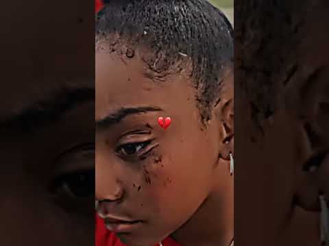 I pray you feel better lani 😁😁 #feelbetternow #sad #scar #red #edit #lanilove #lanilovedits