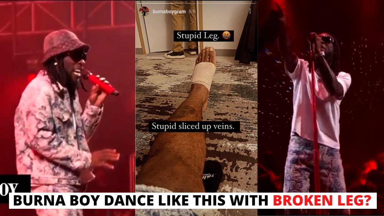 Watch Burna Boy Performing With A Broken Leg At The Made In America ...