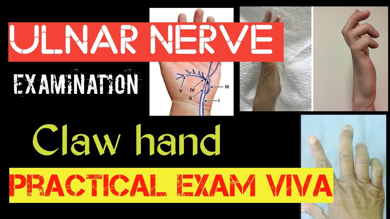 Examination of #Ulnar nerve #nerve#orthopedics#practical exam# clawhand ...