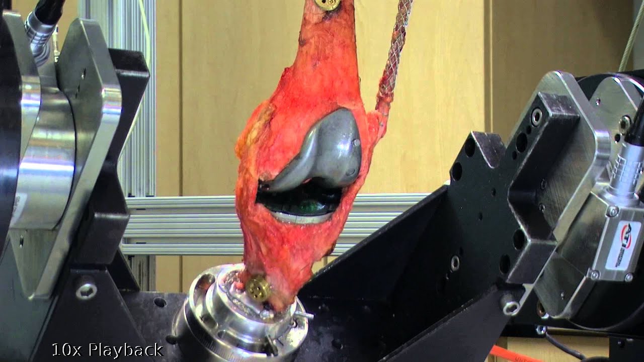 Cleveland Clinic BioRobotics Lab - OrthoSensor VERASENSE Knee Testing ...