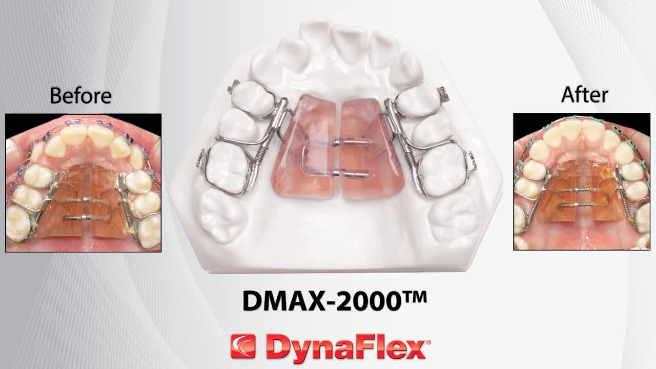 Dynaflex Max 2000 And Dmax 2000 Commercial Youtube