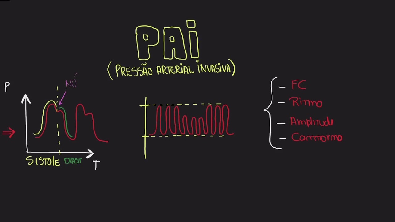 PRESSÃO ARTERIAL INVASIVA - YouTube