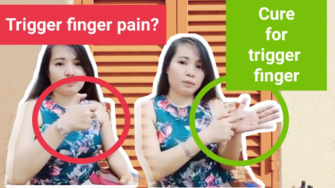 HOW TO CURE TRIGGER FINGER? *ACTIVE RELEASE TECHNIQUE* - YouTube