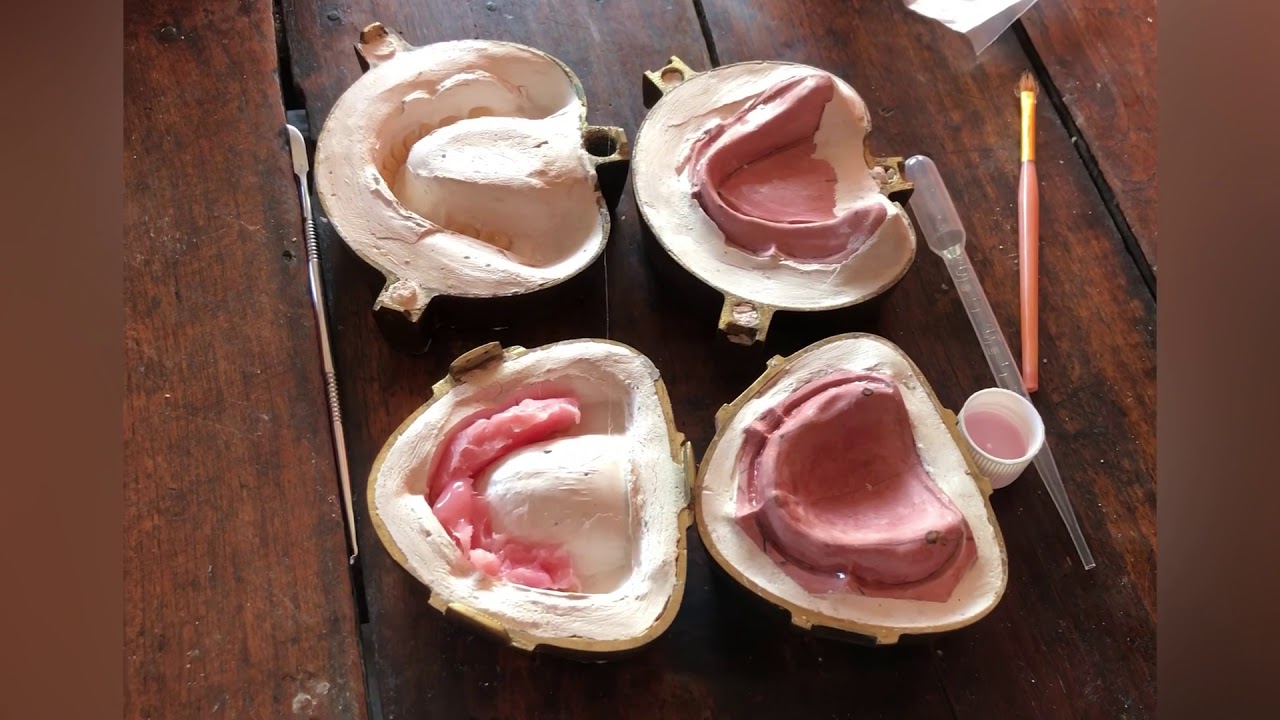 ACRYLIC PACKING (Complete Denture) - YouTube