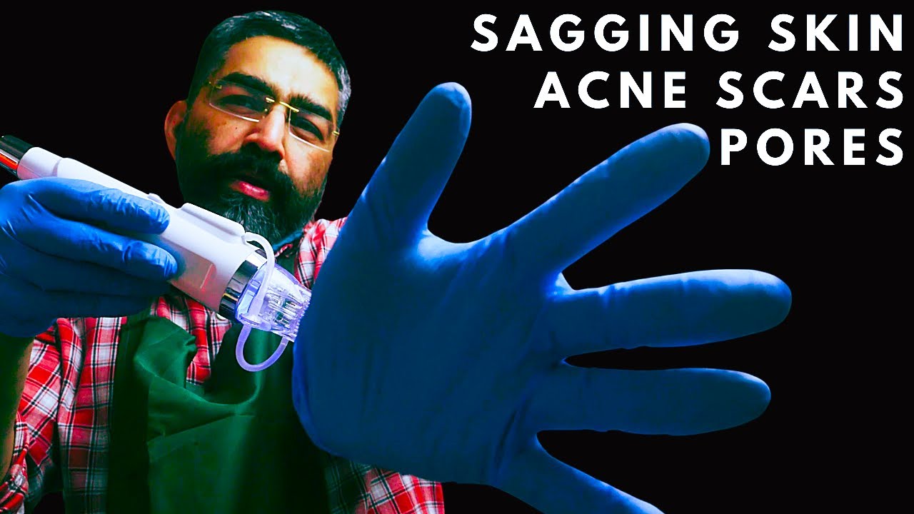 MNRF | microneedling radiofrequency | sagging skin | acne scars | pores ...