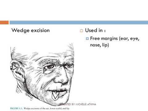 PRINCIPLES, TECHNIQUES, AND BASIC SCIENCE OF PLASTIC SURGERY - YouTube