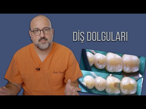 Diş Dolguları ve Amalgam