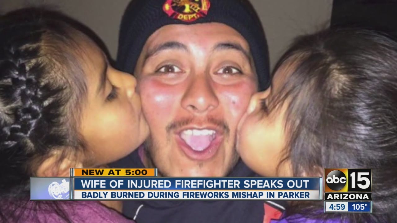 Wife of firefighter injured during fireworks mishap speaks out - YouTube