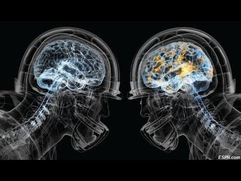 Why is it - Football Helmets Can't Prevent CTE? - YouTube