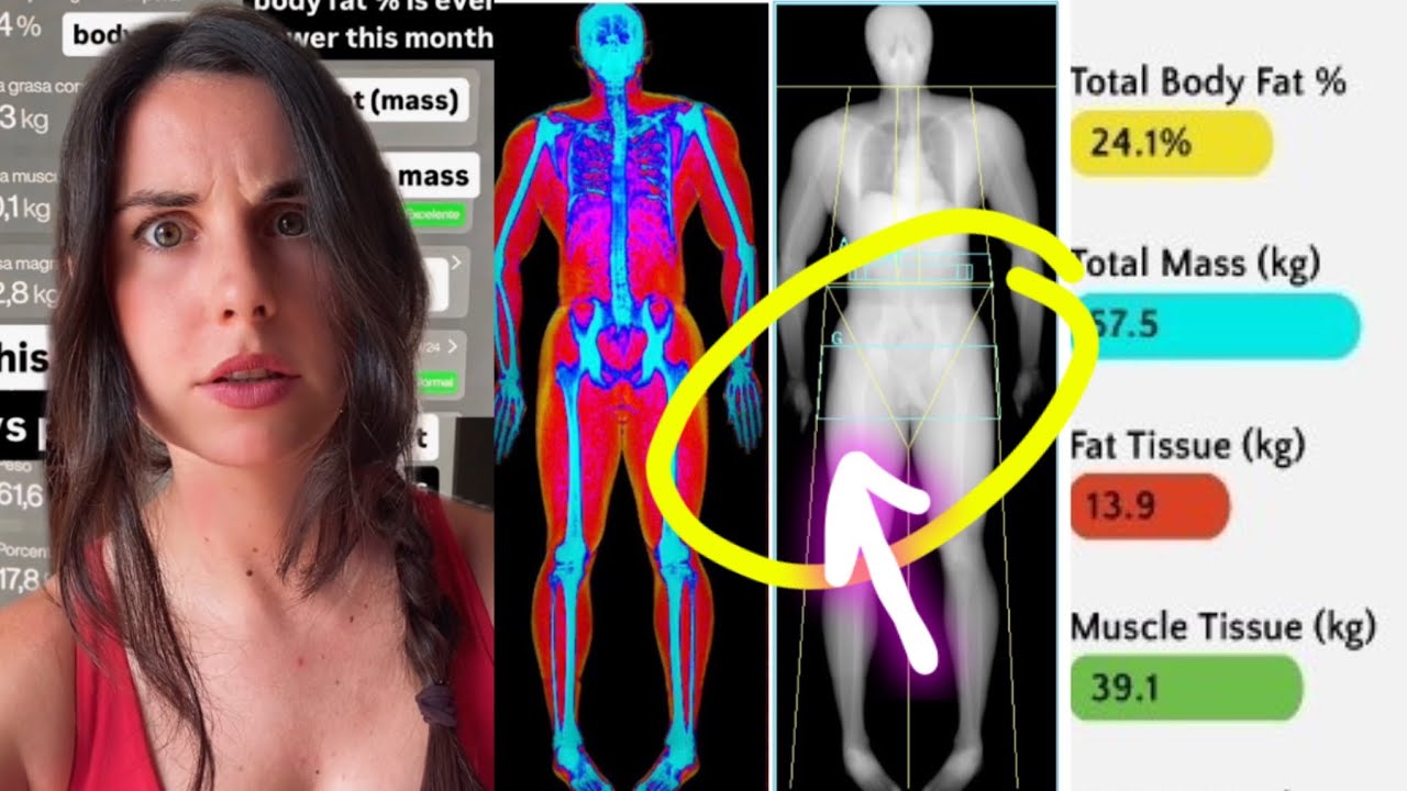 Have you gained weight or is it water retention? Or inflammation? FAT ...