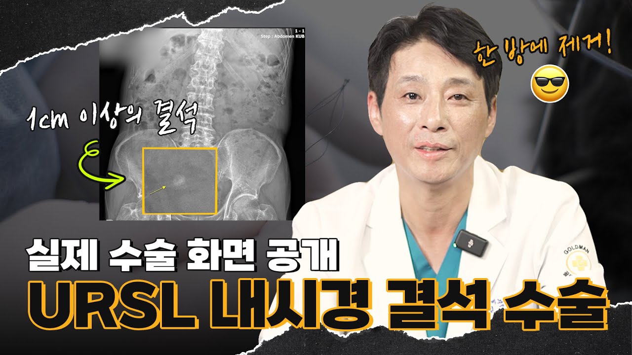 요로결석을 내시경 수술로 해결합니다! 실제 수술 화면과 함께 설명해드리는 URSL - YouTube